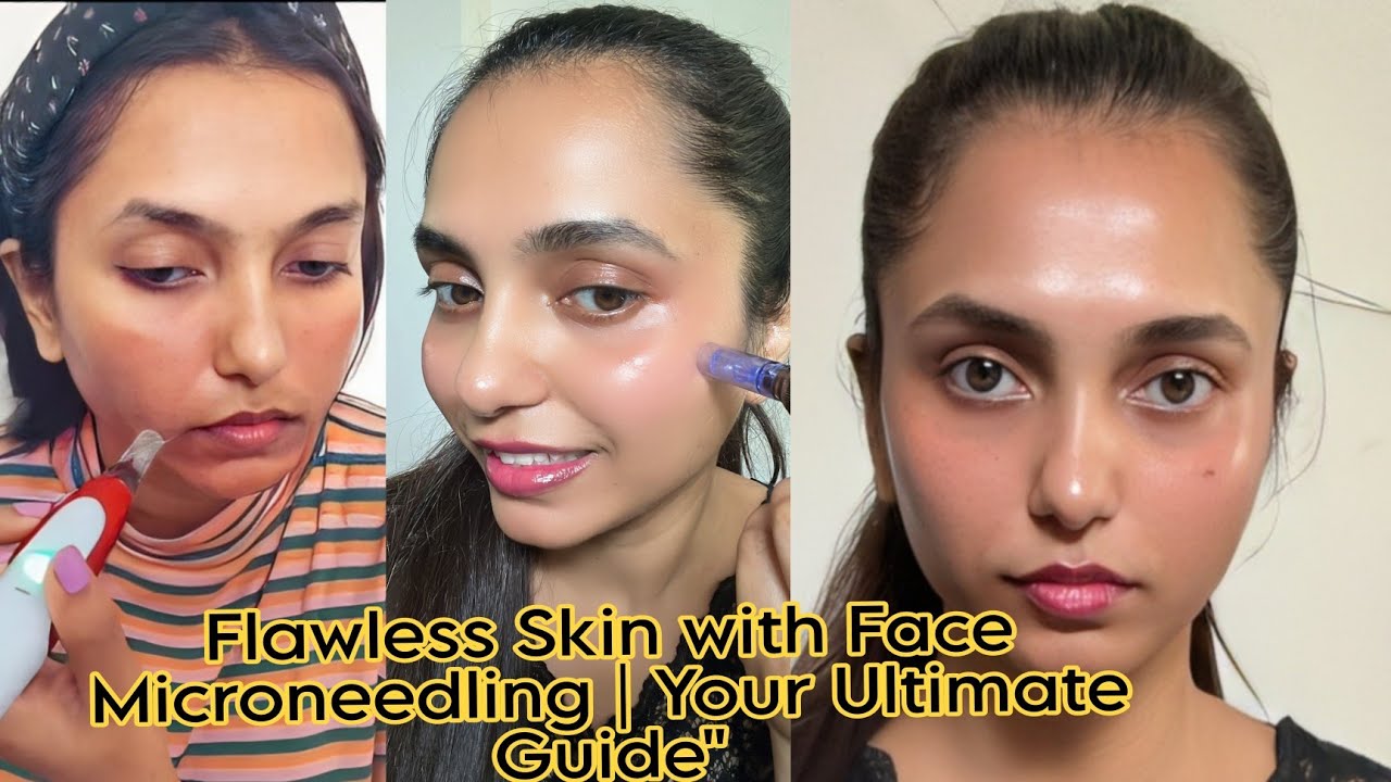 Flawless Skin with Face Microneedling Your Ultimate MICRONEEDLING AT ...