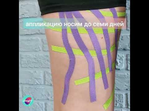 КОРРЕКЦИЯ ЦЕЛЛЮЛИТА. - YouTube