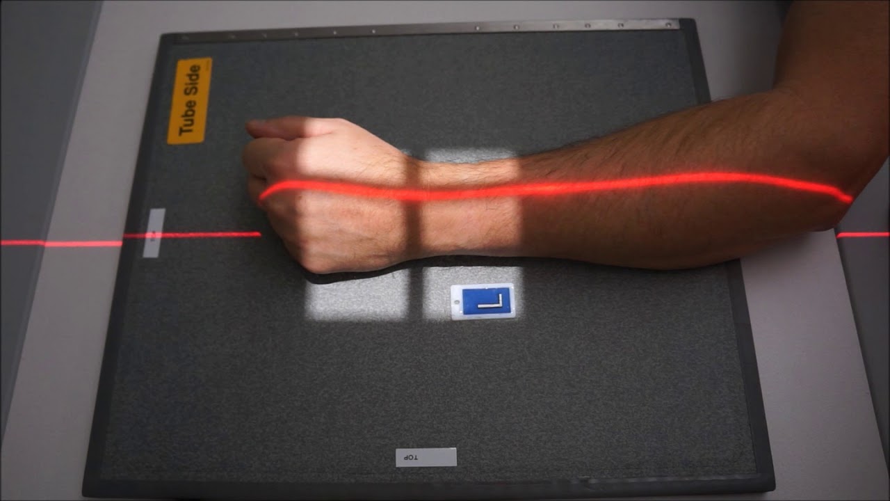 Wrist - PA, Oblique and Lateral - YouTube