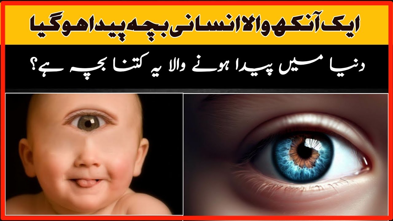One Eye Baby Born in Iraq | Dajjal ka Waqia | Syed Views - YouTube