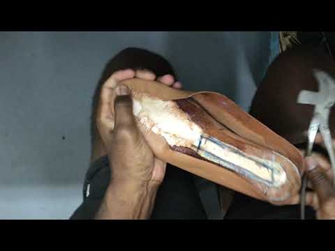 toe stiffener and closing upper prep - YouTube