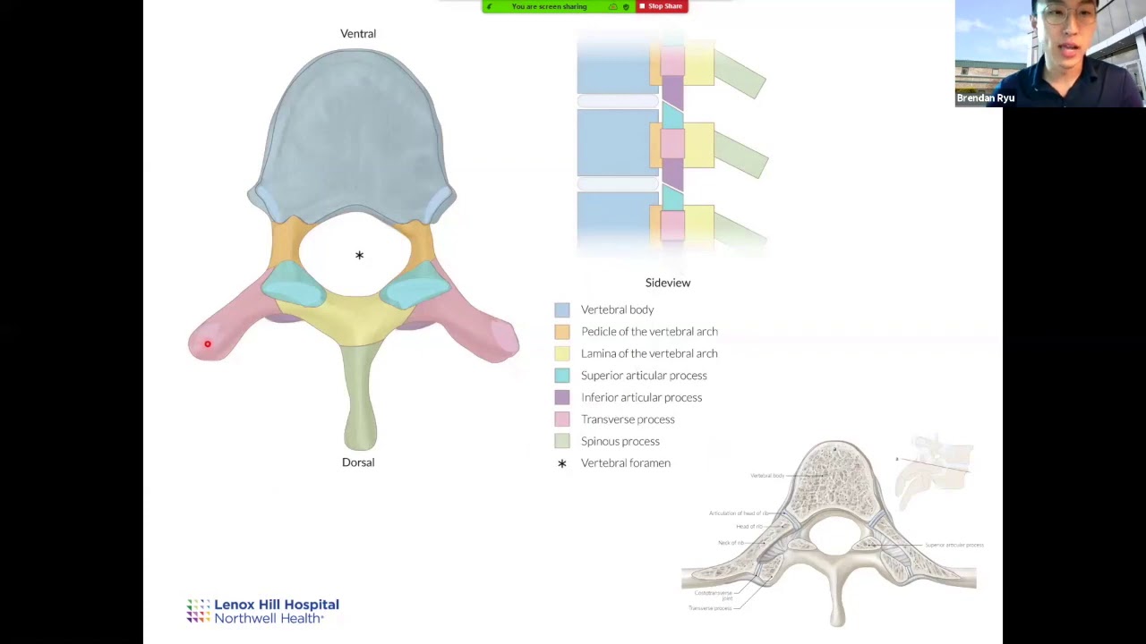 Med School Anatomy: CNS Structure Spinal Cord and Vertebrae with ...
