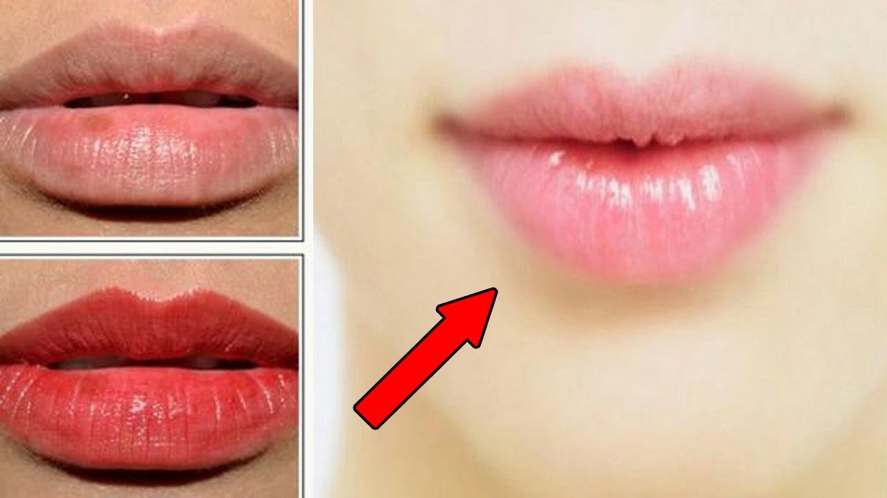 How to make your dark lips pink naturally with this secret remedy - YouTube