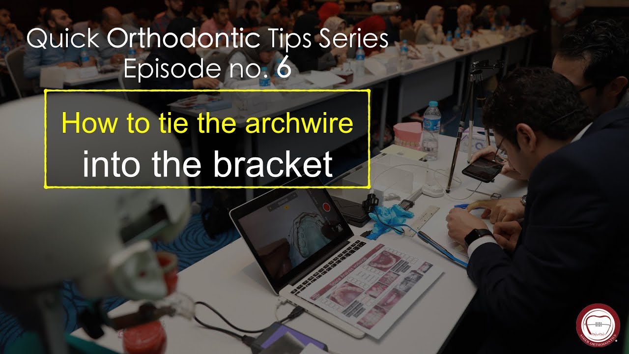 figure-8 O tie and ligature tie, episode no.6 , Quick orthodontic tips ...