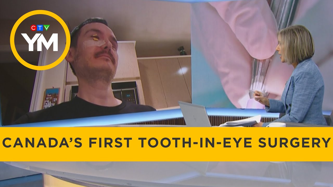 Canada’s First Tooth-in-Eye Surgery | Your Morning - YouTube
