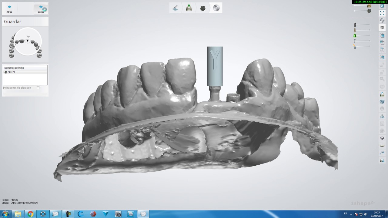 COMO HACER SCANBODYS (3SHAPE) - YouTube