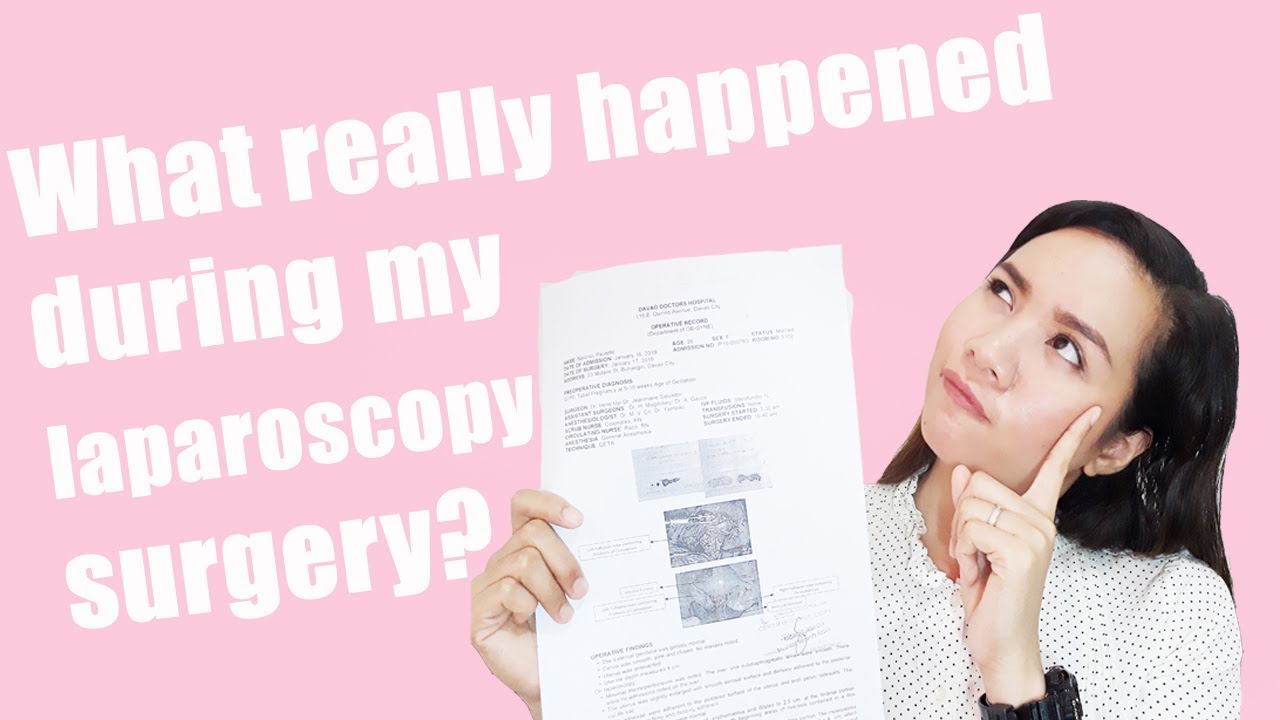 My laparoscopy surgery and salpingectomy experience - YouTube