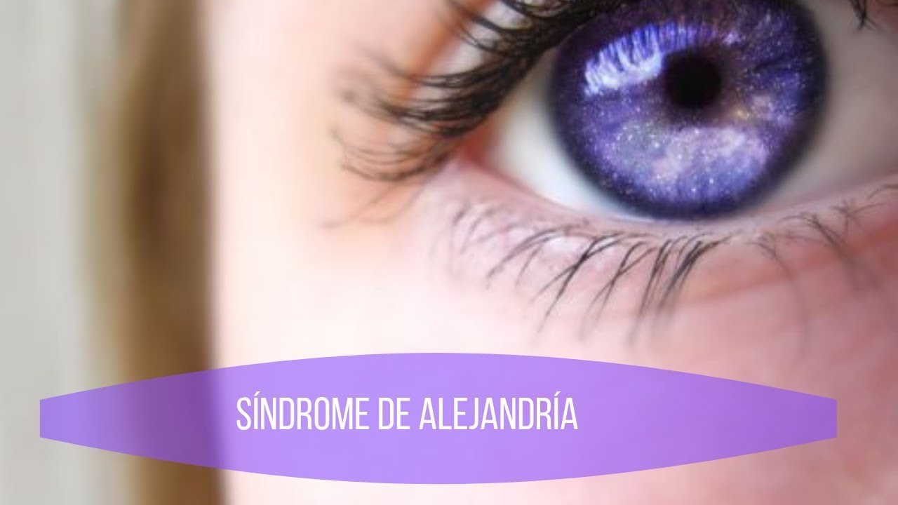 El verdadero caso de los ojos violetas o síndrome de Alejandría - YouTube