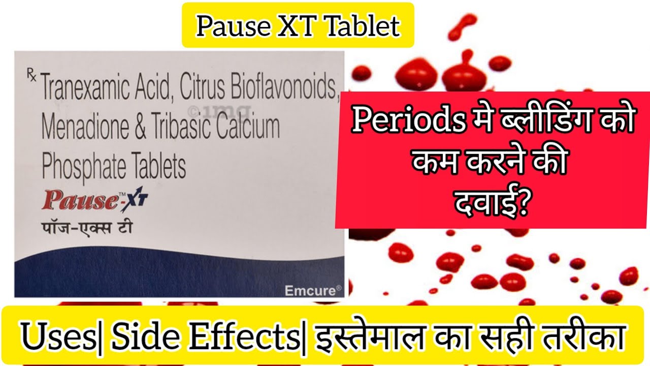 Pause XT Tablet Uses in Hindi Side Effect Tranexamic +Tribasic Calcium ...
