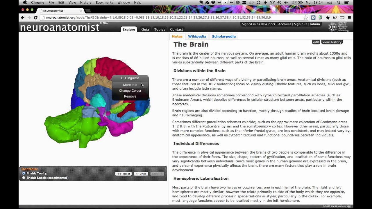 neuroanatomist demo 5/11/12 - YouTube