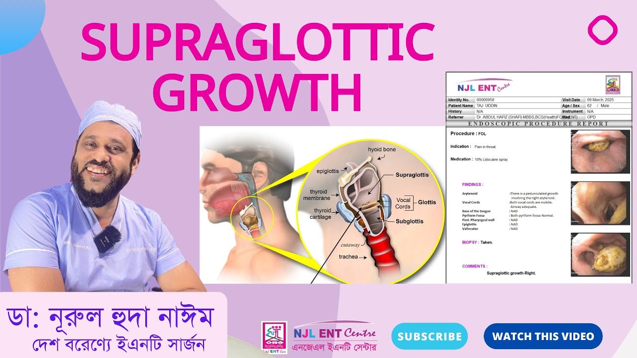 Supraglottic Growth - YouTube
