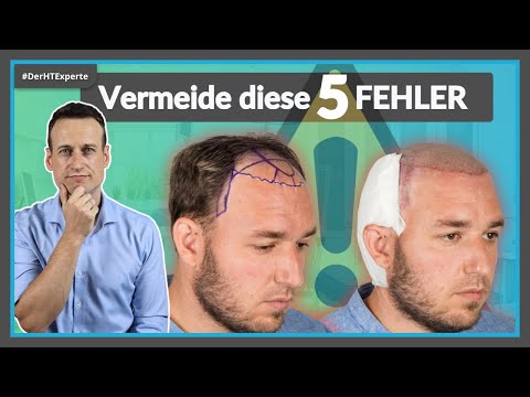 Die 5 größten Fehler NACH einer Haartransplantation - auf das richtige VERHALTEN danach kommt es an
