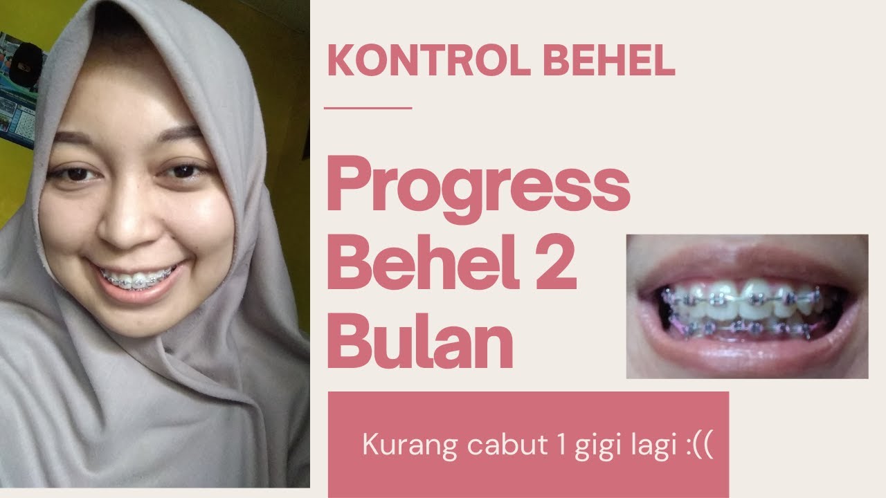 PROGRESS BEHEL 2 BULAN | MASIH KURANG CABUT 1 GIGI LAGI - YouTube