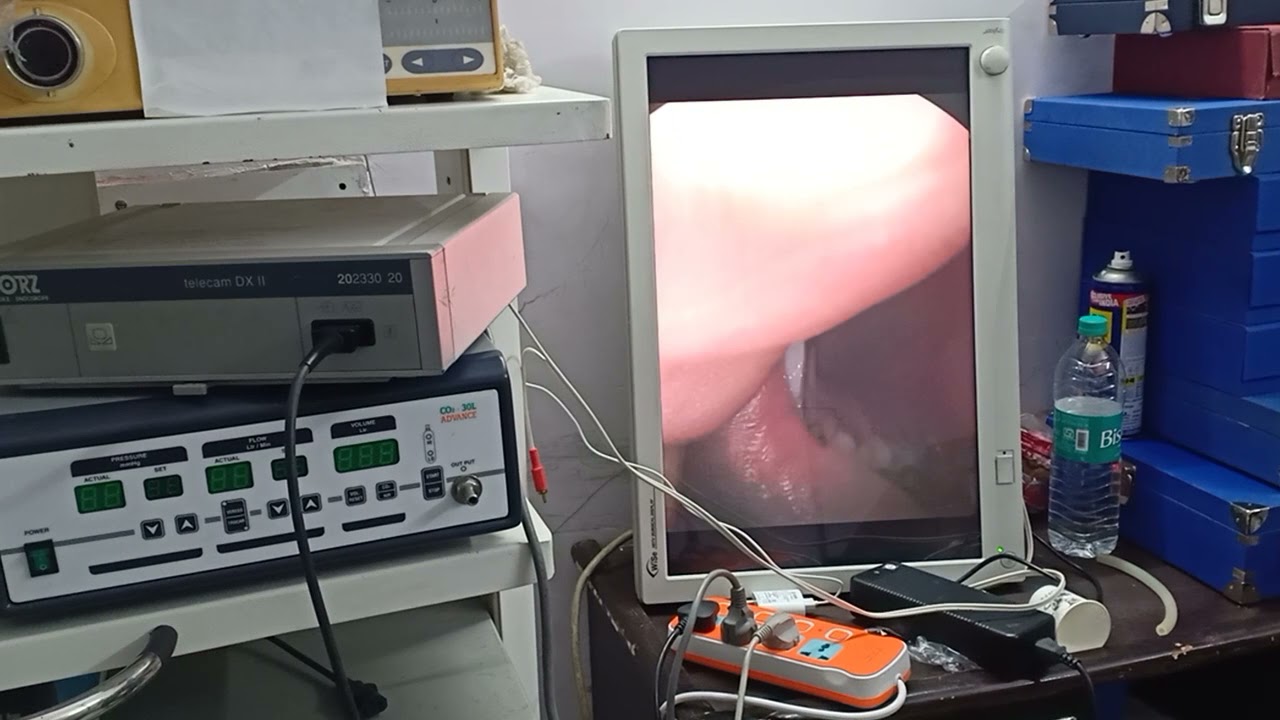 Karl Storz Telecam DX II Karl Storz 10mm 30° Telescope - YouTube