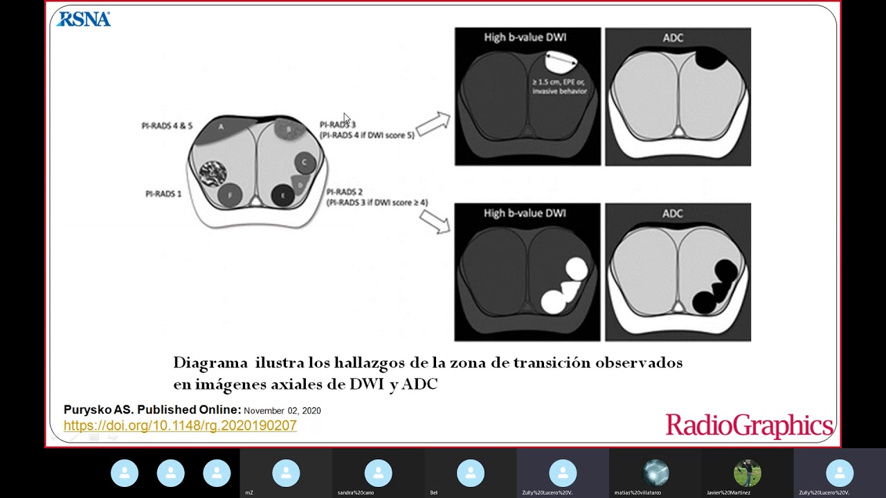 PI RADS 2 1 - YouTube