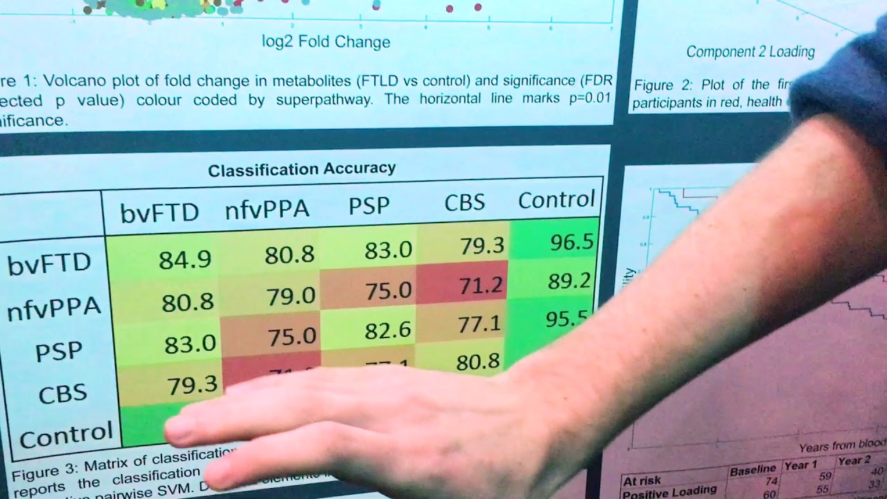 PSP & CBD International Symposium 2018 - YouTube