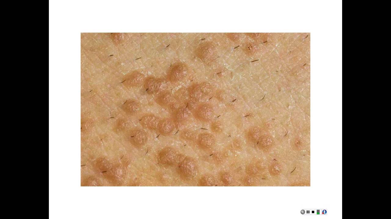 Dirk Elston Sept 9, 2015, Kodachromes - YouTube