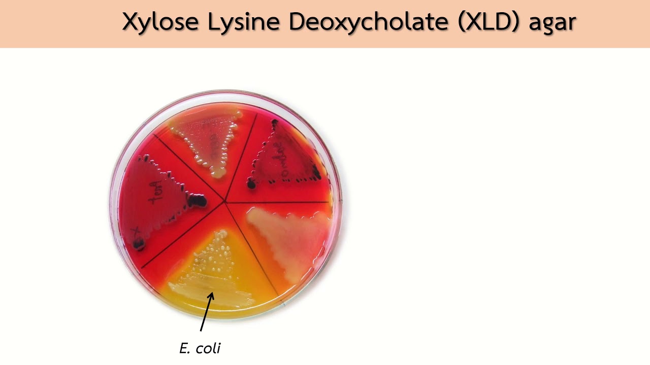 อาหารเพาะเชื้อ XLD agar : HCU - YouTube