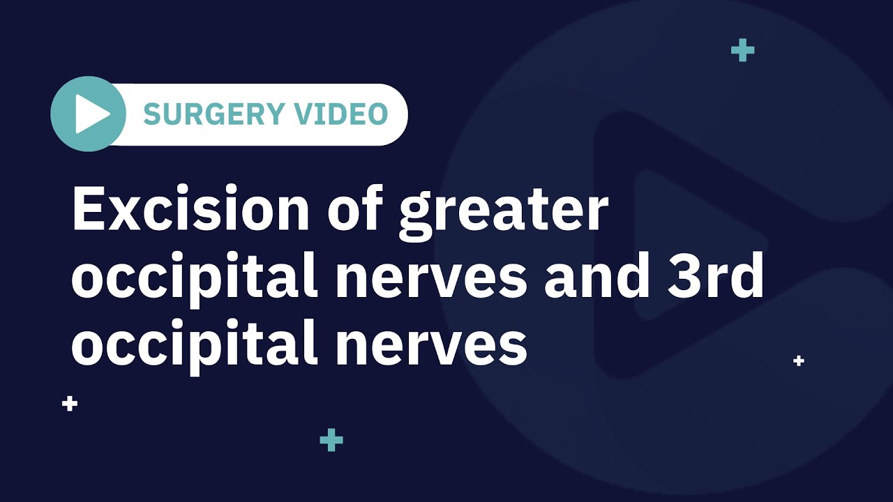Surgery Video: Excision of greater occipital nerves and 3rd occipital ...