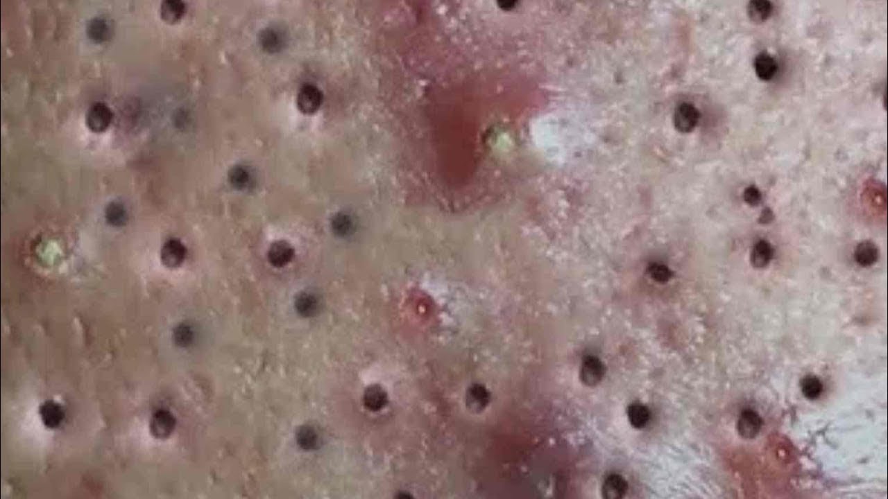 OLHA O TANTO DE CRAVO PRETO - YouTube