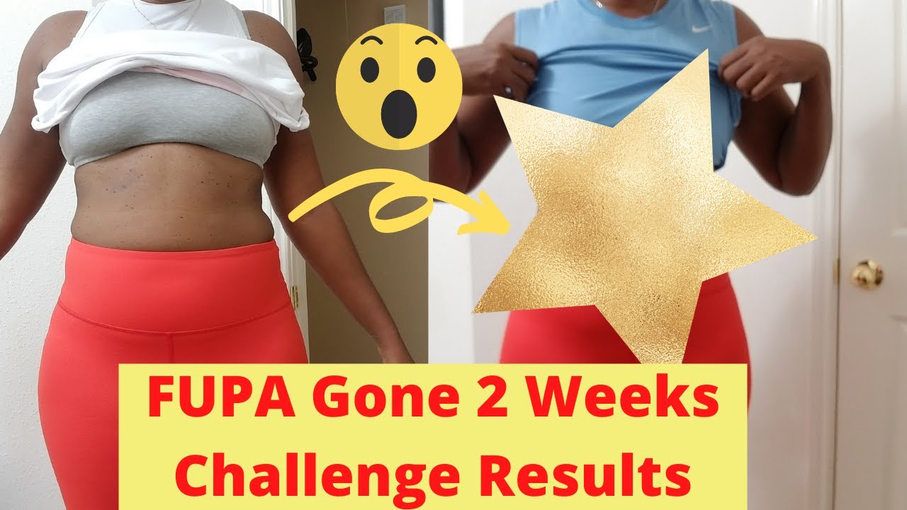 FUPA GONE 2 WEEKS CHALLENGE MY RESULTS - YouTube