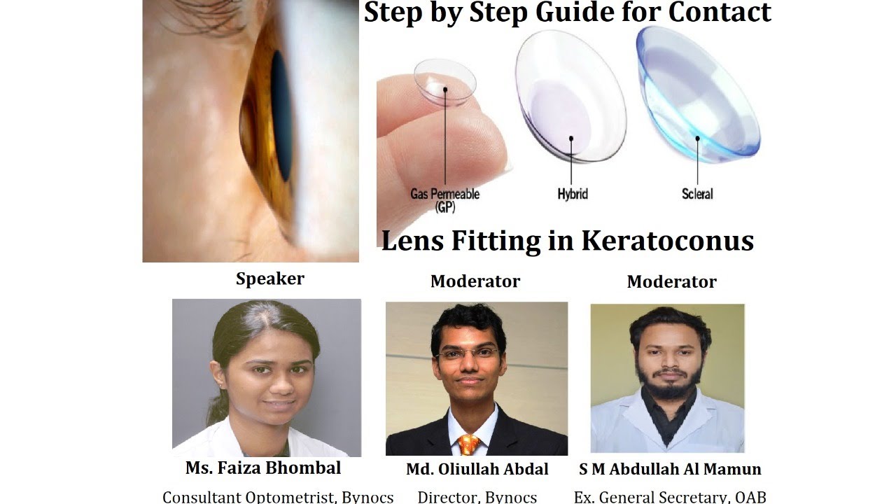 Step By Step Guide For Contact Lens Fitting In Keratoconus by Faiza ...