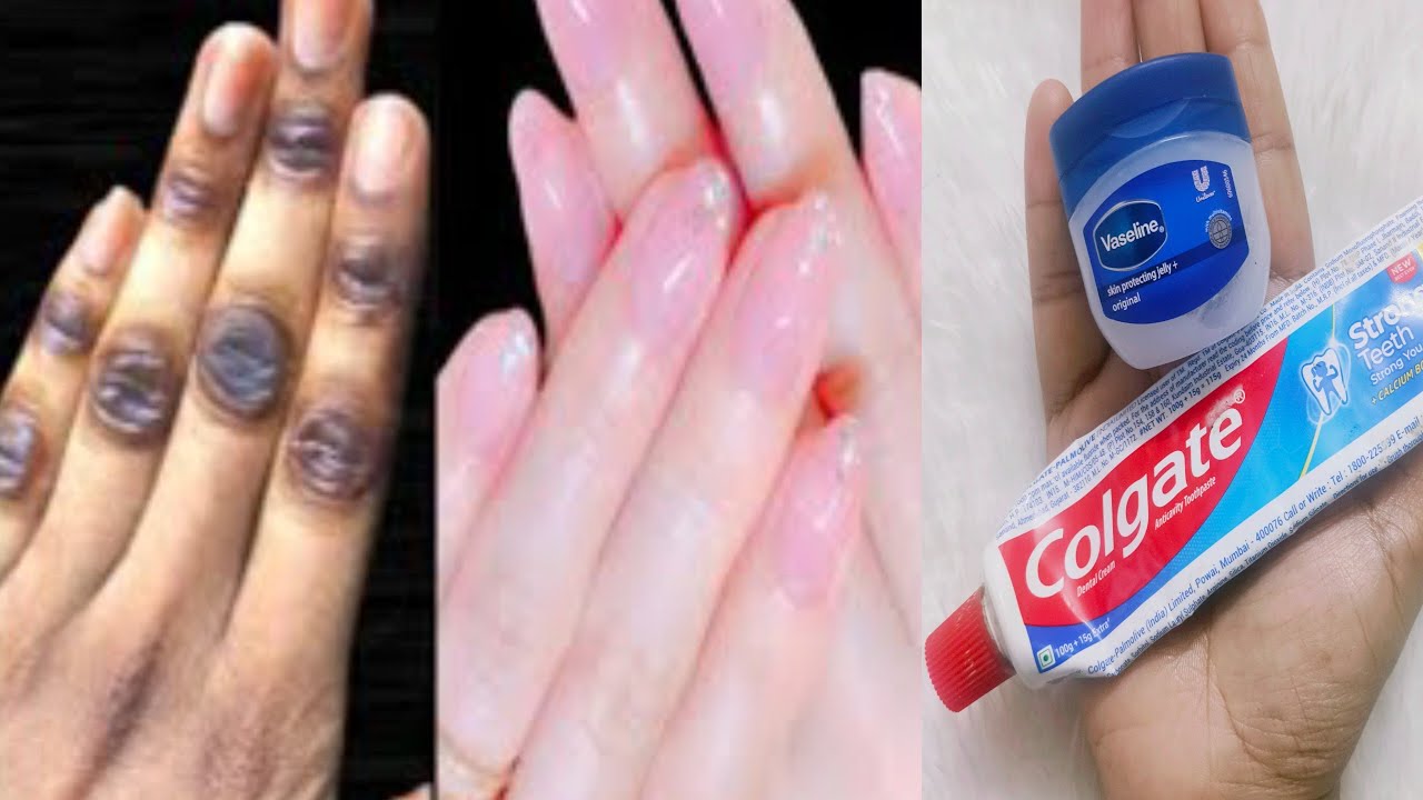 Vaseline and colgate for hand and feet whitening formula | Vaseline and ...