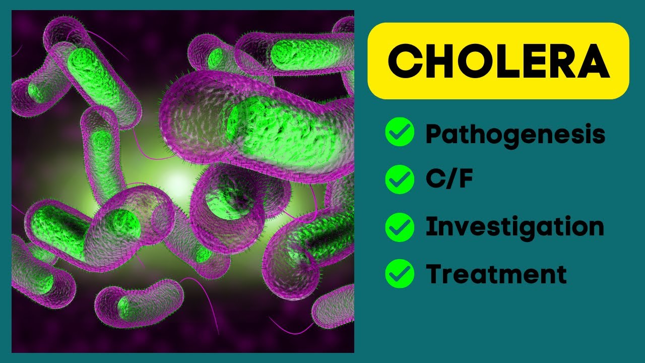 Cholera (Vibrio Cholerae) |Pathophysiology|Clinical Features ...
