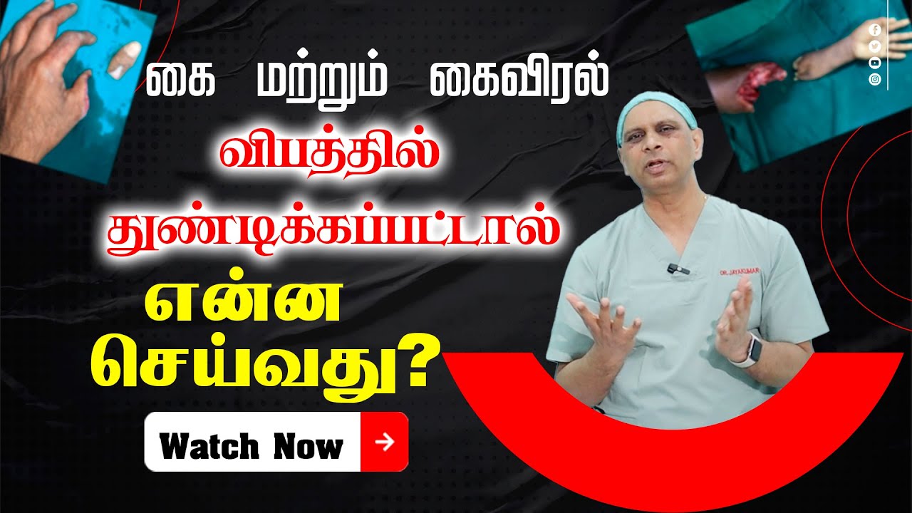 கை மற்றும் கைவிரல் விபத்தில் துண்டிக்கப்பட்டால்என்ன செய்வது? Explain Dr ...