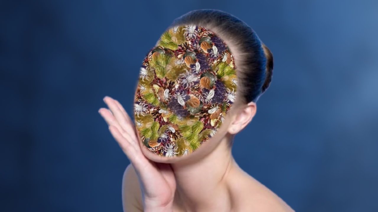 ASMR Infected Girl Treatment|Maggots Face Animation #animation - YouTube