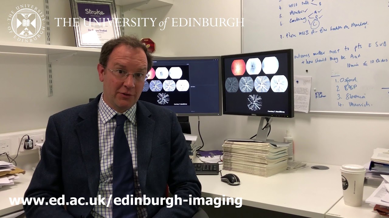Dr Fergus Doubal, Edinburgh Imaging - YouTube
