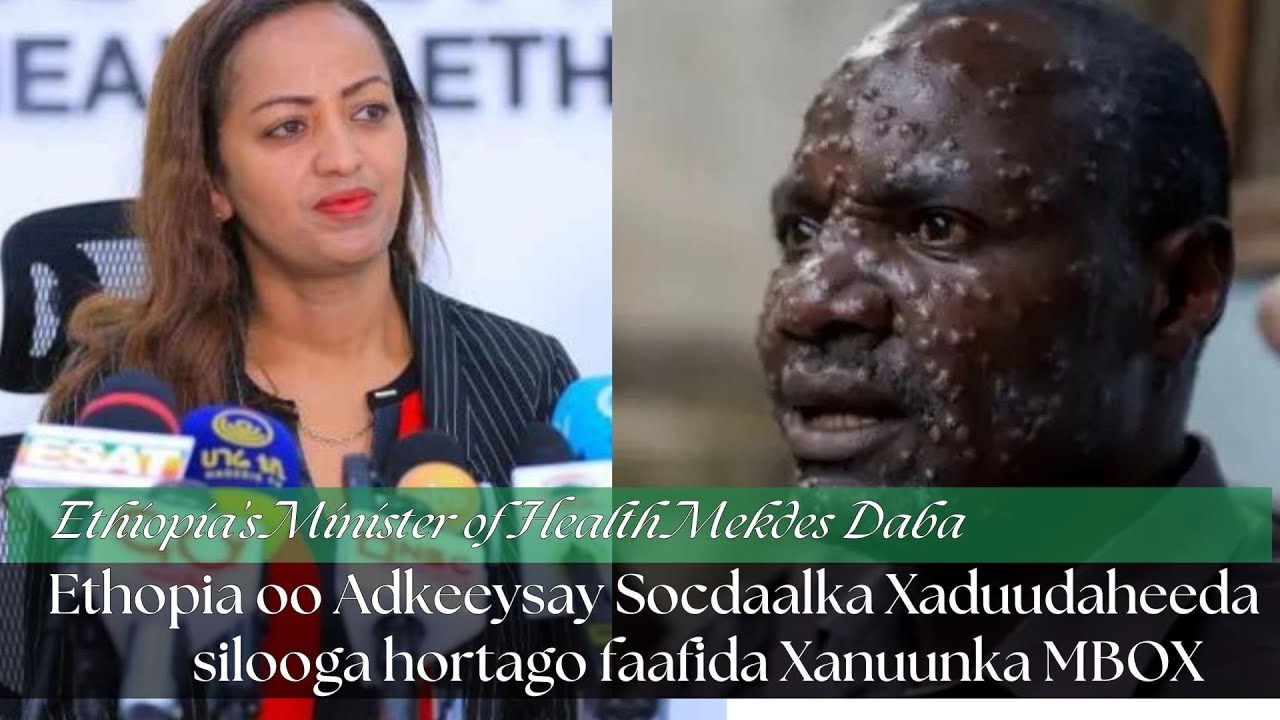 Ethopia Oo Adkeeysay Socdaalka Xaduudaheeda Silooga Hortago Faafida ethopia-oo-adkeeysay-socdaalka-xaduudaheeda-silooga-hortago-faafida