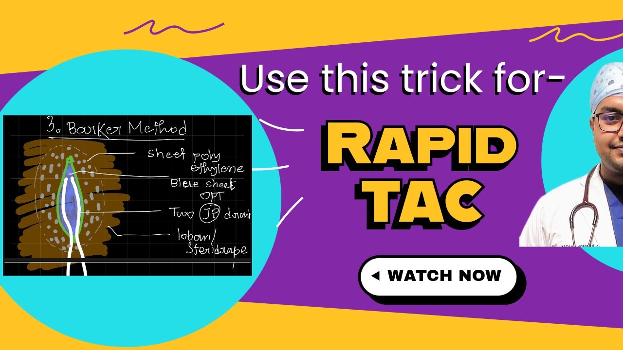 Use this trick for a temporary abdominal closure (TAC) | Modified ...