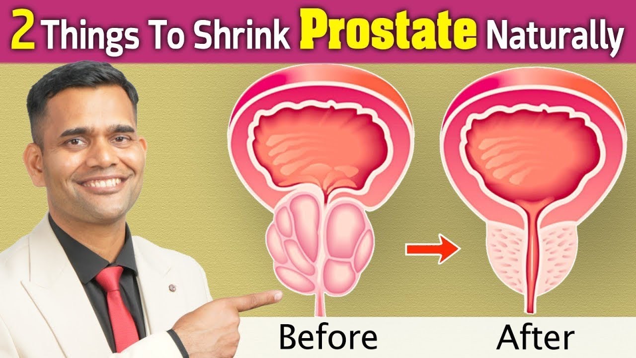 2 Things To Shrink Prostate Naturally Shrink Your Enlarged Prostate