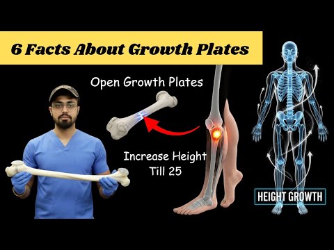 6 Facts About Growth Plates For HEIGHT Increase | Open Growth Plates Till 25 |Get Growth Spurt At 20