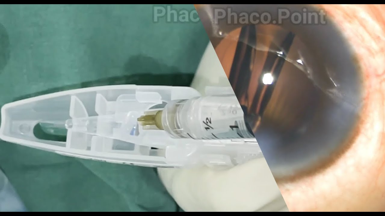 A Step by step guide to loading and inserting the pre loaded HOYA IOL ...