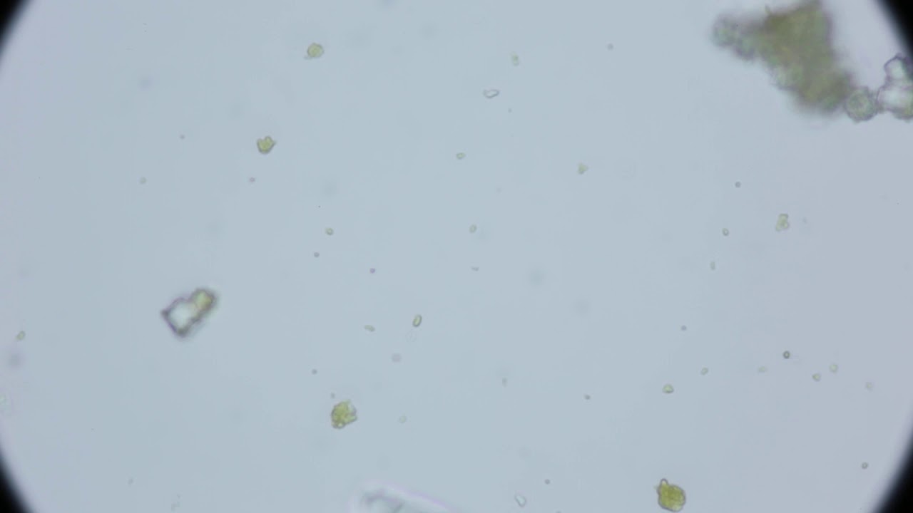 Antarctic Bacteria (200x) from Blood Falls #10 - YouTube