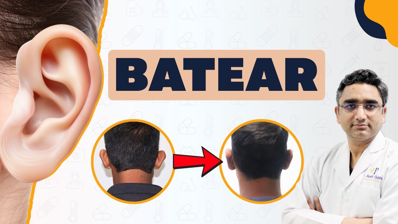 Prominent Ears Deformity Correction | How to Treat & Before After ...