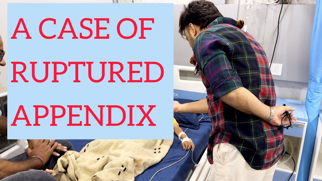 A case of rupture appendix. #drimranpatel - YouTube