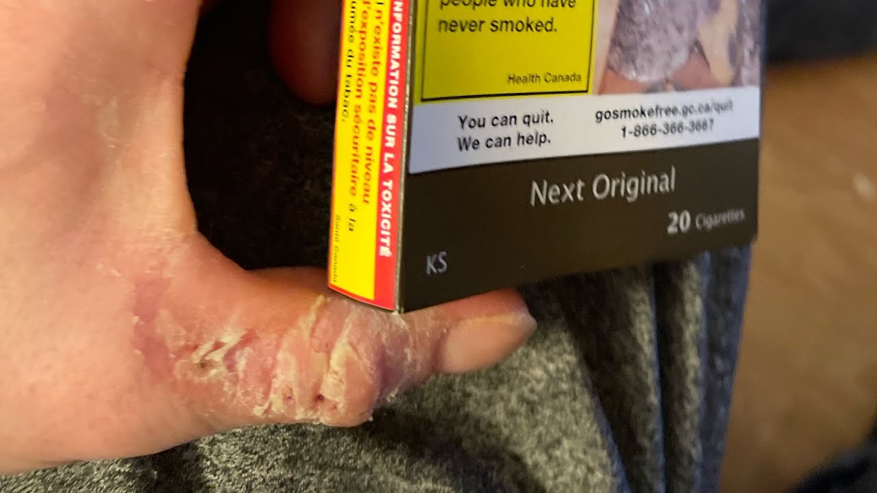 Post plain Packaging laws GRAPHICS! We need to check this out ! - YouTube
