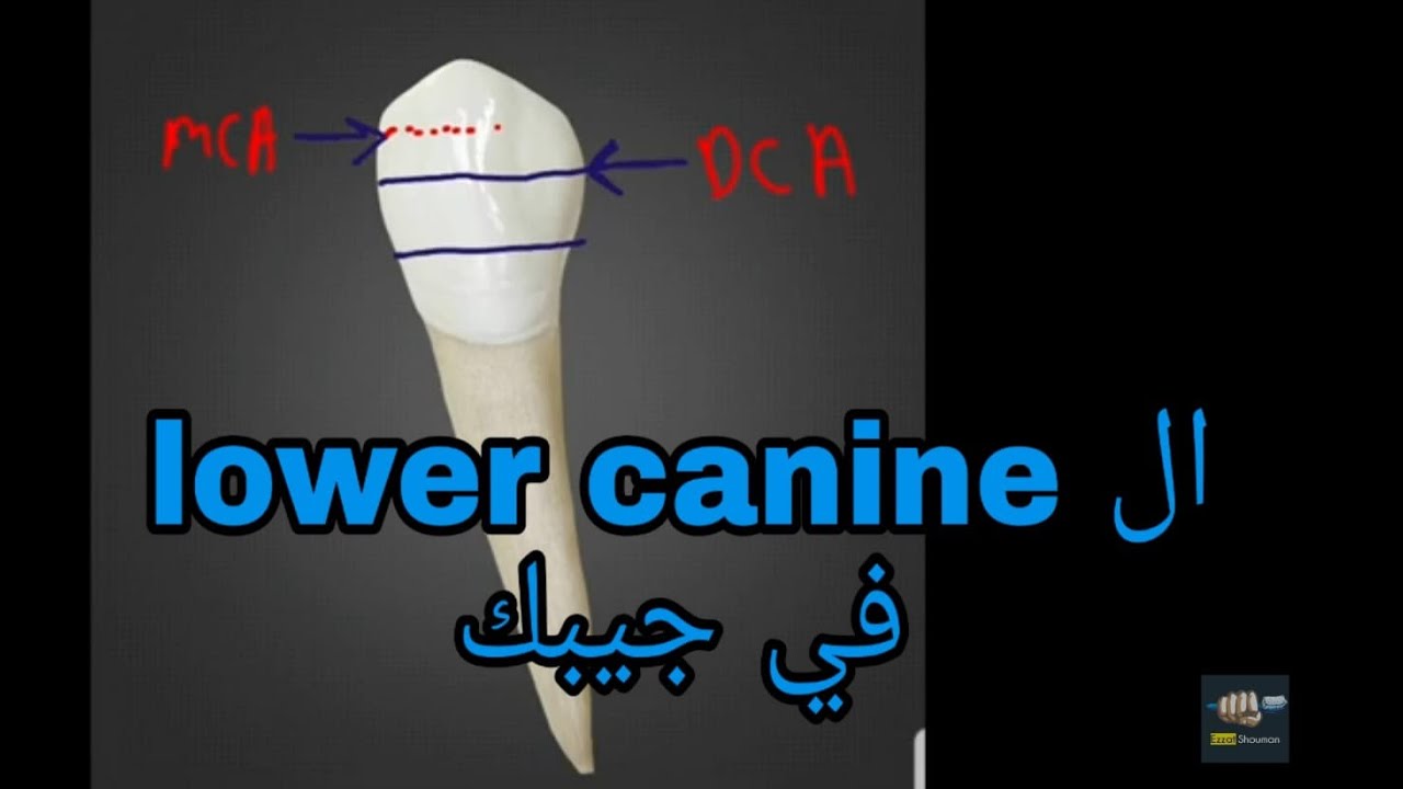 Lower canine "lower cuspid" - YouTube