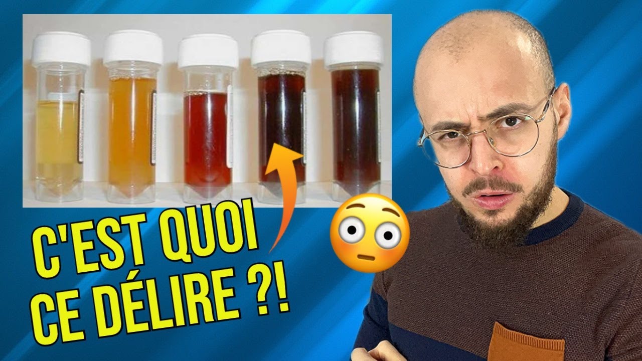 Que cache la COULEUR de votre URINE ?! - YouTube
