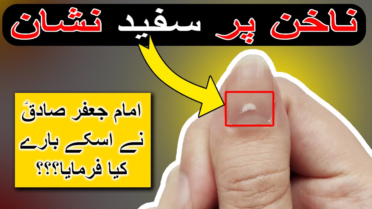 Why We Have White Marks On Nails Imam Jafar Sadiq AS Saying why-we-have-white-marks-on-nails-imam-jafar-sadiq-as-saying