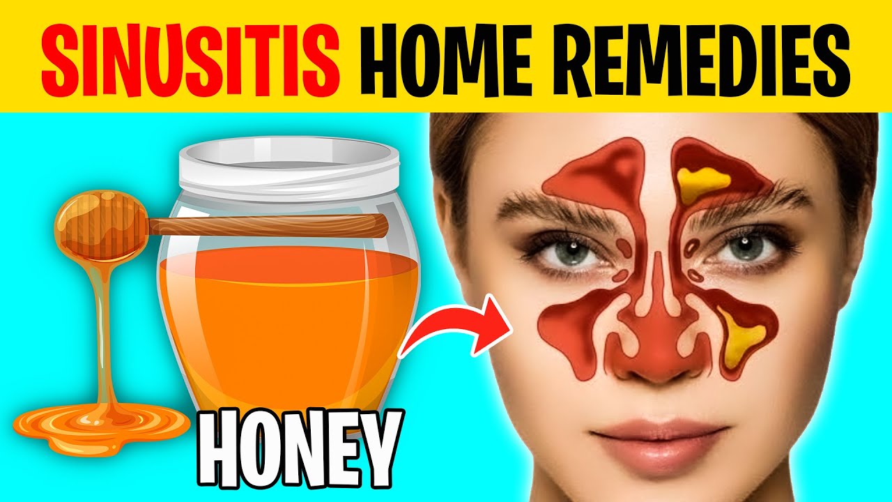 10 Home Remedies to Get Rid of Sinusitis - YouTube