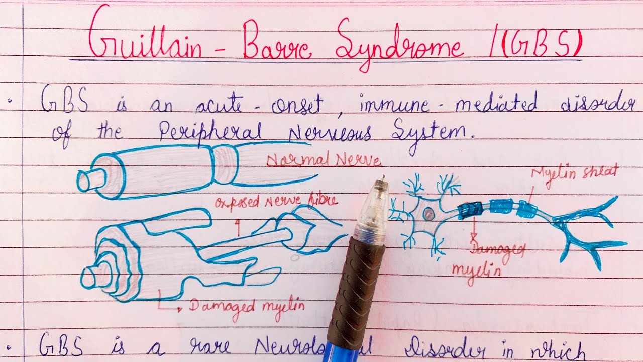 Guillain Barre Syndrome - symptoms, causes, types , diagnosis ...