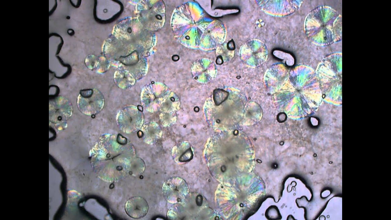 Crystal growth in polyethylene oxide (PEO) - YouTube