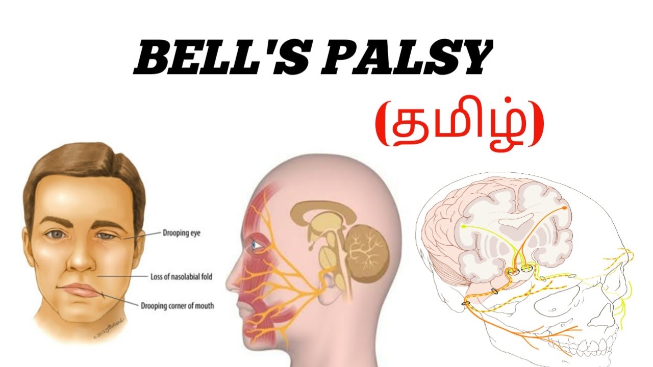 BELL'S PALSY | Facial nerve | தமிழ். - YouTube