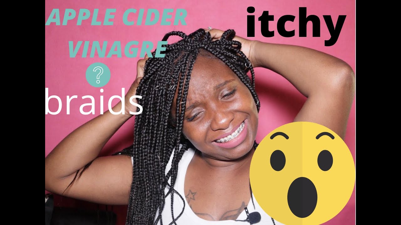 braid gone wrong itching - YouTube