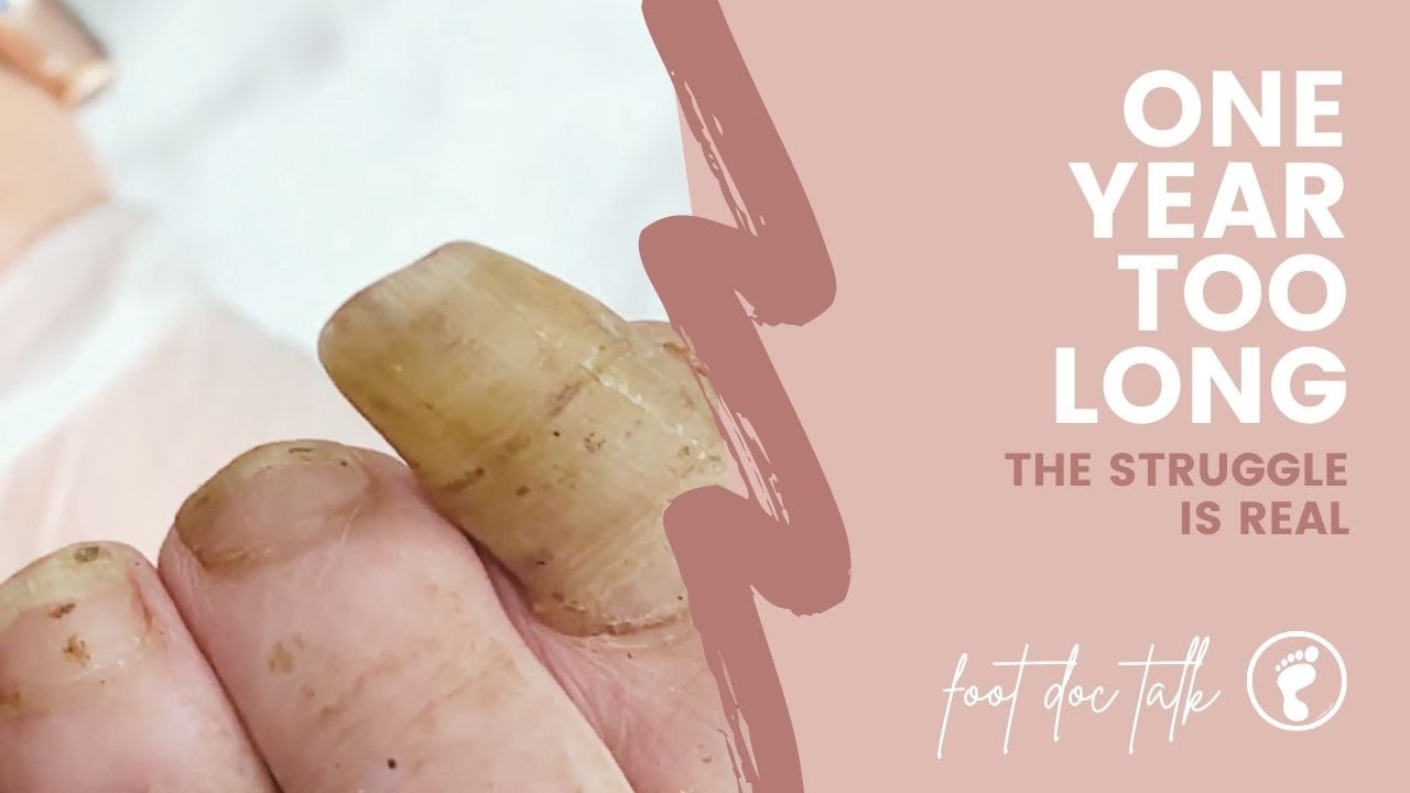 ONE YEAR TOO LONG ⏰ - YouTube