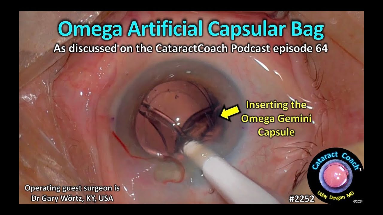 CataractCoach™ 2252: Omega Ophthalmics Artificial Capsular Bag - YouTube